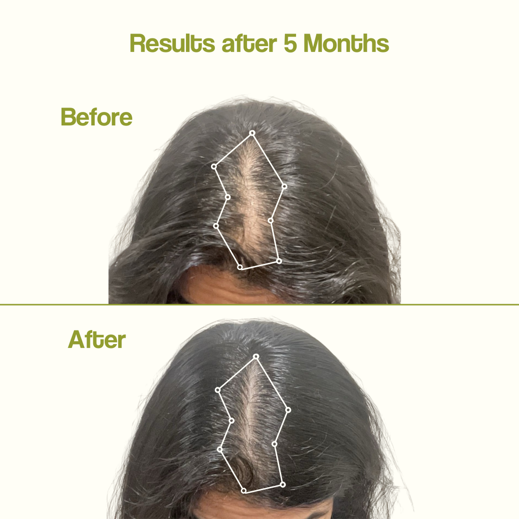 Root Stimulating Elixir – Amright Nutra Private Limited